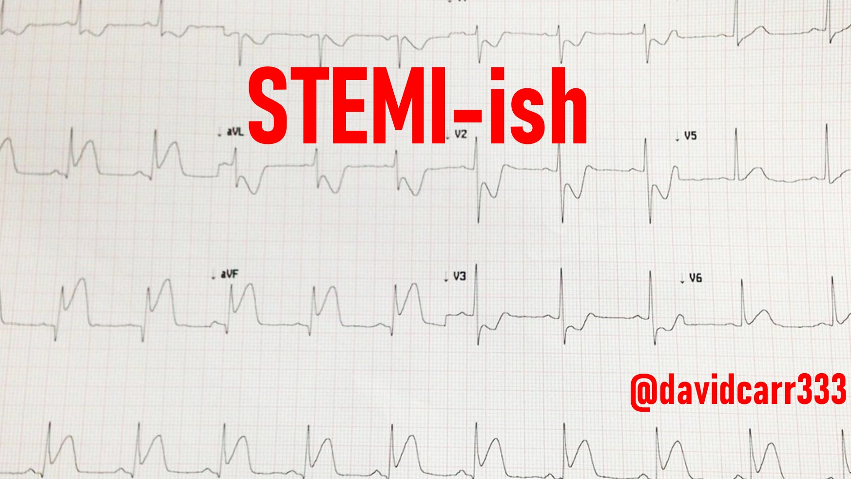 North York General – Emergency Medicine Update